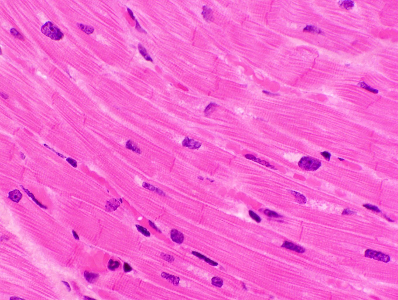 Smooth Muscle Tissue 400x